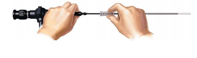 Item Number: 28-36000 - Clearview™ II Flexible Endoscope Cover – Erie ...